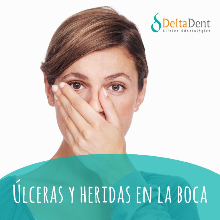 Úlceras y heridas en la boca: Causas, tipos y tratamientos